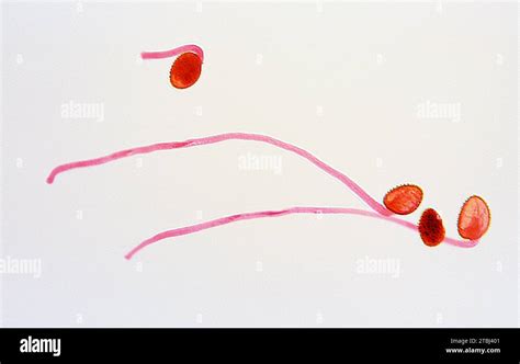 Pollen Grains With Pollen Tube Optical Microscope Magnification X200