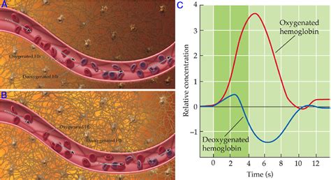 Figure 11 From Statistical Approaches For Resting State Fmri Data Analysis Semantic Scholar