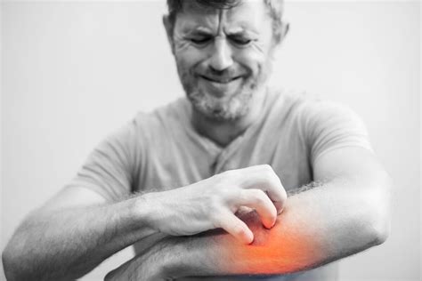 Allergie Della Pelle Come Riconoscerle