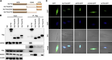 Klf16 Enhances Stress Tolerance Of Colorectal Carcinomas By Modulating