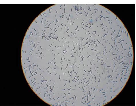 1562c0001000000137 嗜酸乳杆菌 微生物菌种 图片