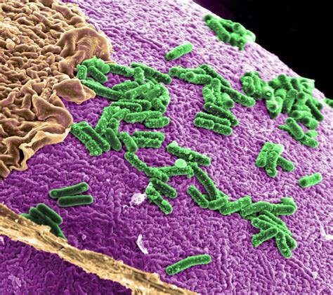 Promenons Nous Dans La Flore Intestinale Rtn Votre Radio Régionale