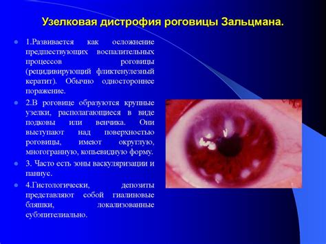Дистрофии роговицы глаза презентация онлайн