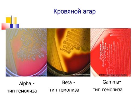 Питательные среды Online Presentation