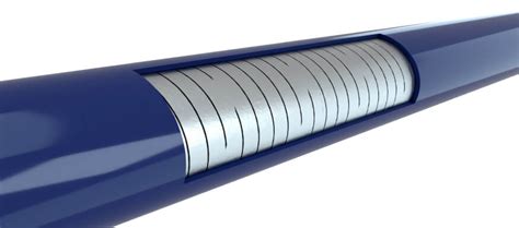 The Pascal Precision System Edwards Lifesciences