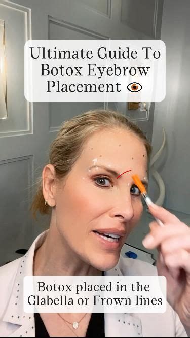 Ultimate Guide To Botox Eyebrow Placement Botox Brow Lift Botox Eyes