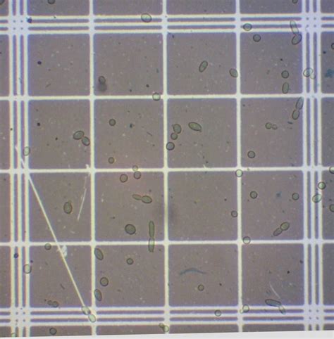 How To Use The Yeast Cell Counting V2 Object Detection Api
