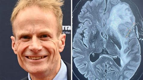 Squirting Study Determines Liquid In Female Sex Act Comes From The Bladder News Com Au