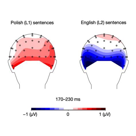 Topographic Distribution Of The Difference Between Erp Amplitudes In