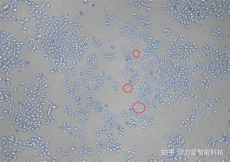 【技术分享】等价类划分法测试细胞汇合度算法识别效果 知乎