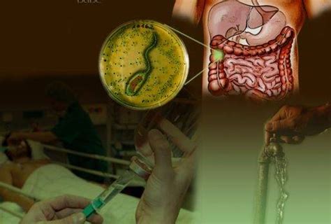 Notifican A La Población Siete Nuevos Casos De Cólera