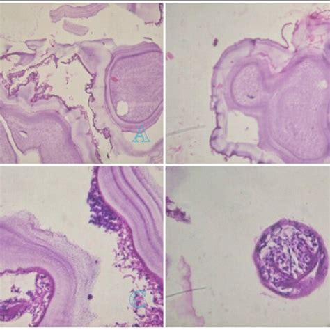 Microscopic Examination Using Haematoxylin And Eosin Staining A 200x