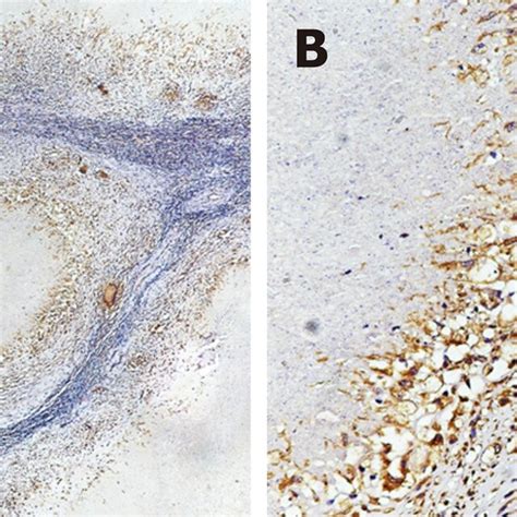 Schematic Diagram Of The Th17 Cell Differentiation Pathway Apc
