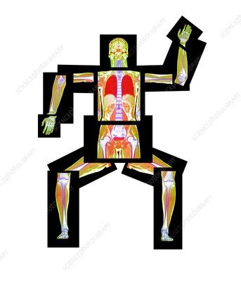 Whole Body MRI Scan Stock Image P835 0053 Science Photo Library