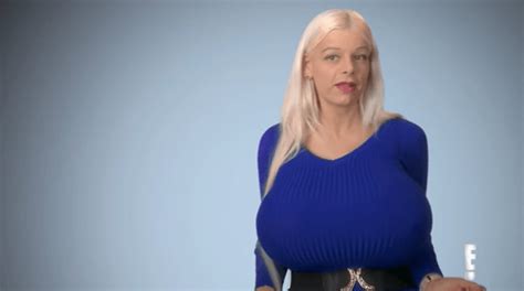 Botched Season 4 Woman With Biggest Breast Implants In Europe Wants A