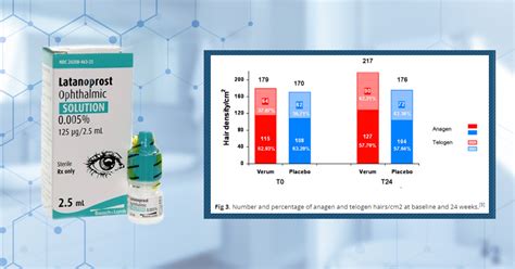 Topical Latanoprost For Hair Growth Uses Doses And Side Effects
