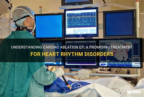Understanding Cardiac Ablation Ep A Promising Treatment For Heart
