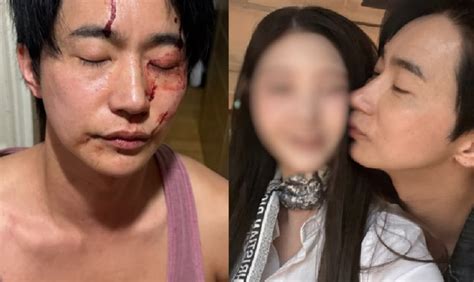 Müzikal Oyuncusu Jeon Ho Jun Eski Sevgilisine Yönelik Şiddet İddialarına Kanlar İçindeki