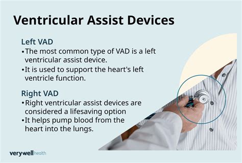 Ventricular Assist Device Types Uses Life Expectancy