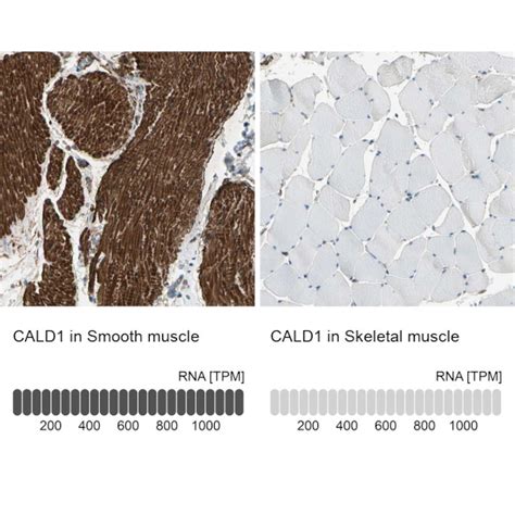 Caldesmon Polyclonal Antibody Pa5 82334