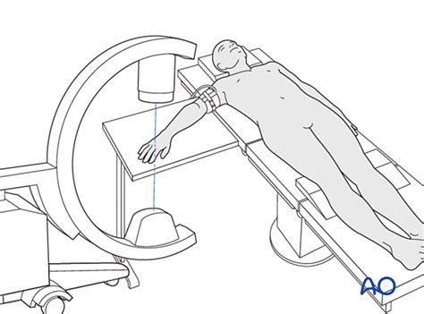 Supine Patient Position
