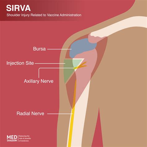Shoulder Pain After Vaccination When Do I Need To See A Doctor