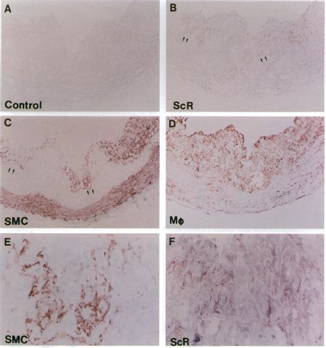 Immunoperoxidase Staining For Scr Expression And Cell Type