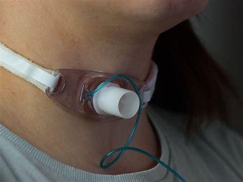 Tracheostomy Plug