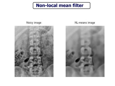 Math 3360 Mathematical Imaging Ppt Download