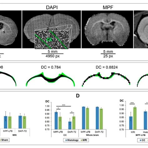 Correspondence Between The Transformed And Delineated Cc And Brain