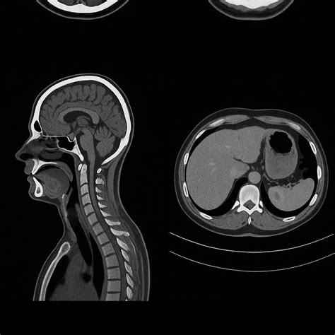 Laudo Radiologico Youtube