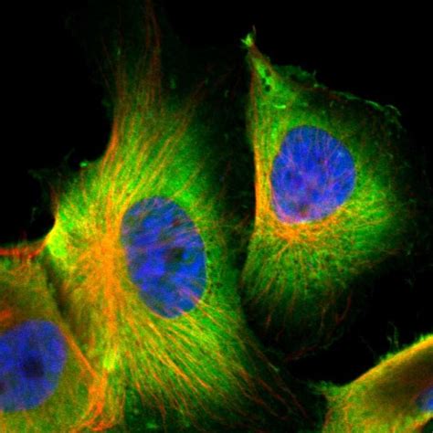 Rabbit Polyclonal Anti S100a6 Antibody Buy For Research Highly