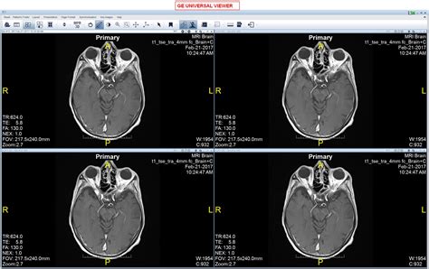 Configure Dicom Image Display Size In Osimis Web Viewer Google Groups
