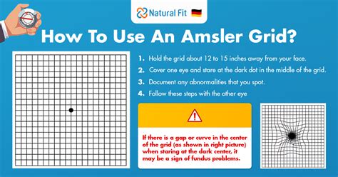 Abnormal Amsler Grid