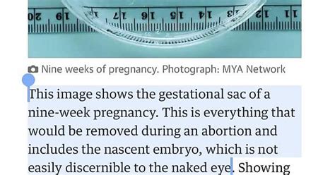 Excerpt From Guardian Article “what A Pregnancy Actually Looks Like Before 0 Weeks In