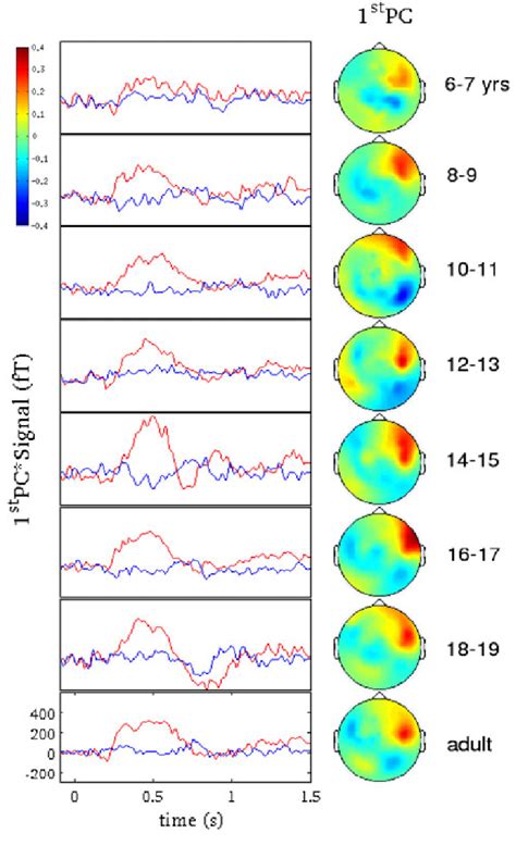 Right Topographic Plot Of 1st Principle Component For Each Age Group Download Scientific