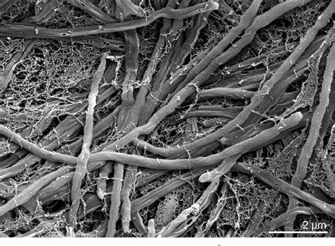 Hauser Ambulation Index Functional Test Semantic Scholar