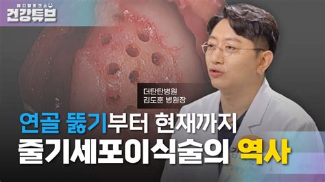 Knn건강튜브 재생률 50 줄기세포이식술의 발전 Youtube