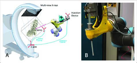 Robotic Injection System A Schematic Of The Relationship For