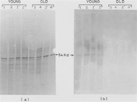 Aa 10 Sds Page Of Immunoprecipitated 35s Methionine Labelled