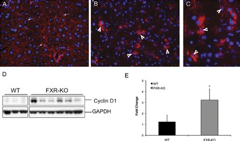 Catenin Activation Results In Cyclin D1 Up Regulation And Is Download Scientific Diagram