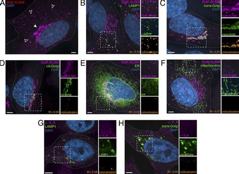 Sidk Al568 Detects The V Atpase In Acidic Intracellular Organelles A
