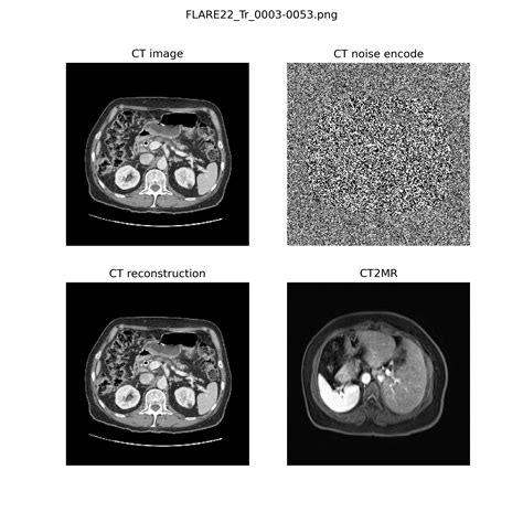 Train The Unpaired Image To Image Translation On One Gpu · Issue 9 · Chenwu98cycle Diffusion