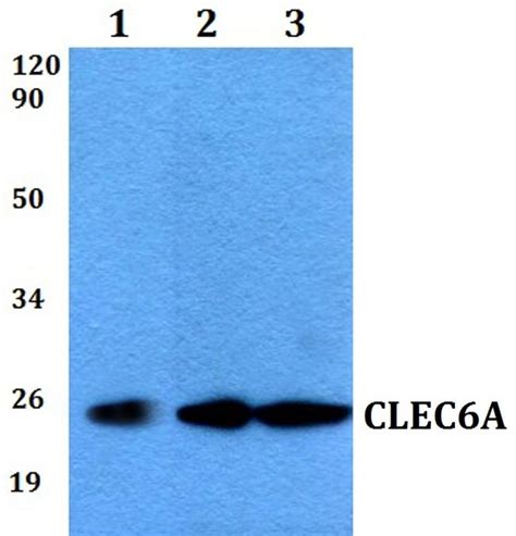 Dectin 2 Polyclonal Antibody Pa5 75724
