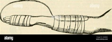 Metacarpo Phalangeal Joint Banque De Photographies Et Dimages à Haute Résolution Alamy
