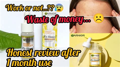 Garnier Vitamin C Serum Honest Review In ಕನ್ನಡ ️ Beauty Viralvideo