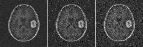 Mri Image A Original Image B Image Degraded By Salt Pepper Download Scientific Diagram