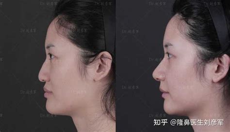 鹰钩鼻真的好看吗 知乎