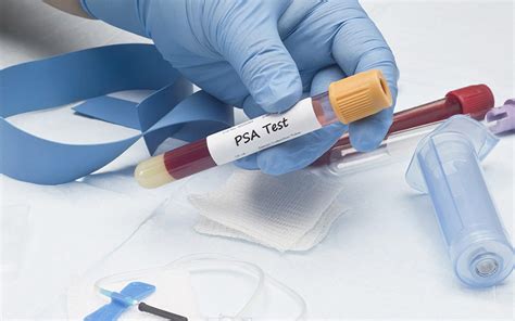Novos Dados Sobre Cancro Da Próstata O Que Significam