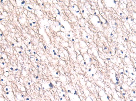 兔抗plaur多克隆抗体anti Plaur Rabbit Polyclonal Antibody 生命科学产品与技术服务 生工生物工程